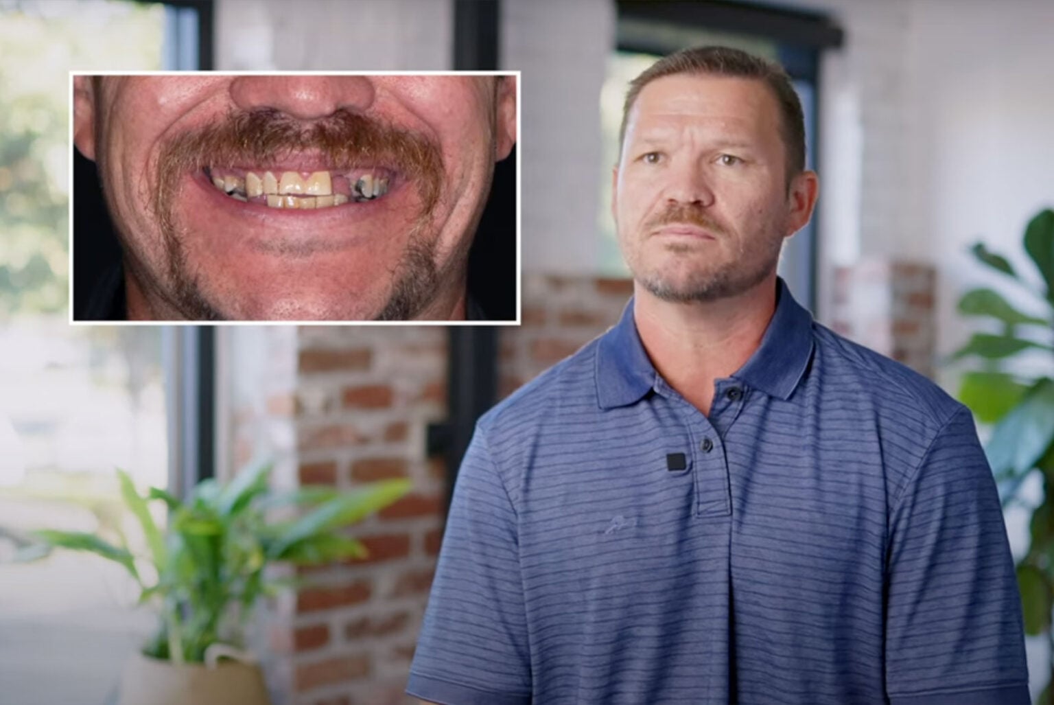 Home - Next Smile Implant